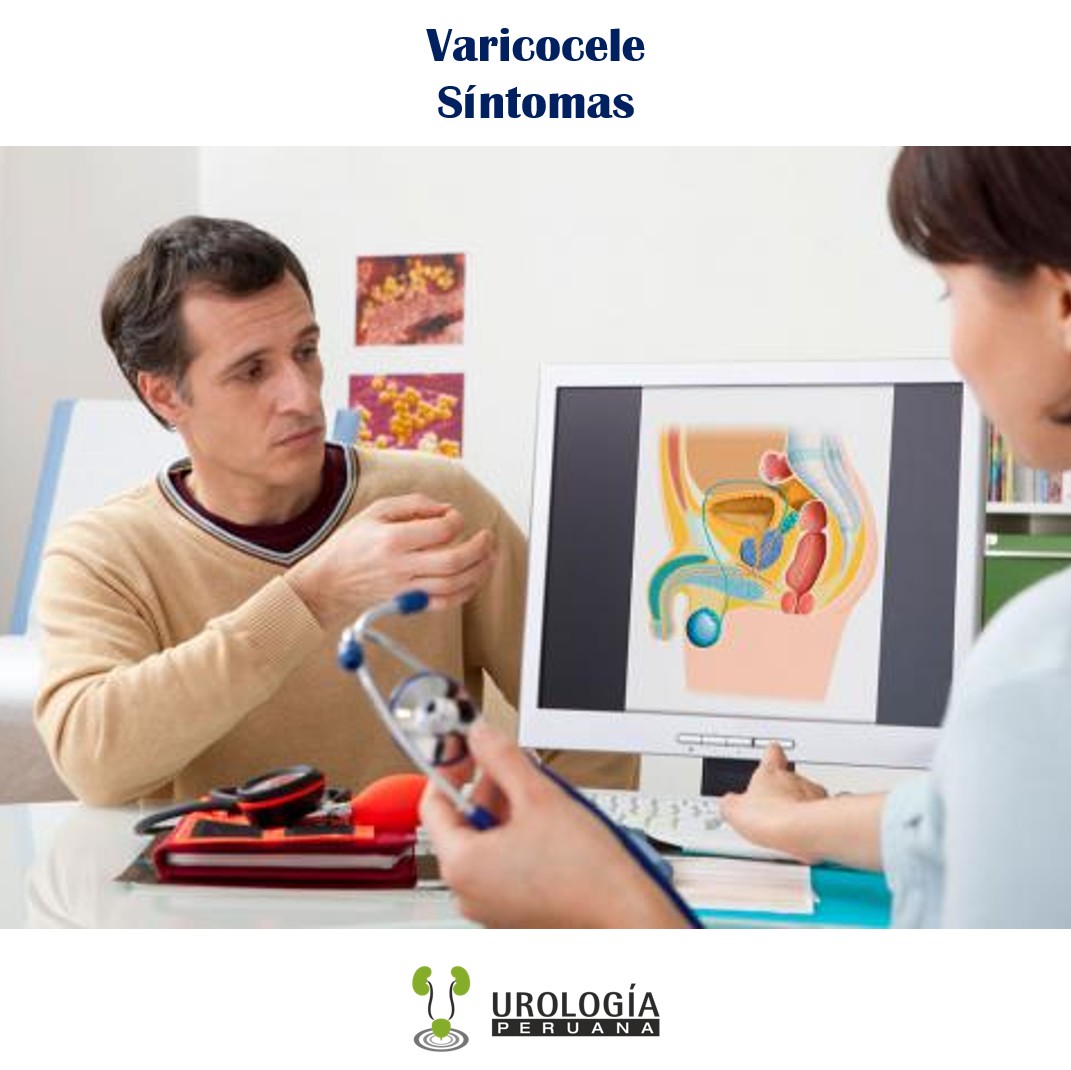 Varicocele, síntomas – Urología Peruana. Dr. Susaníbar