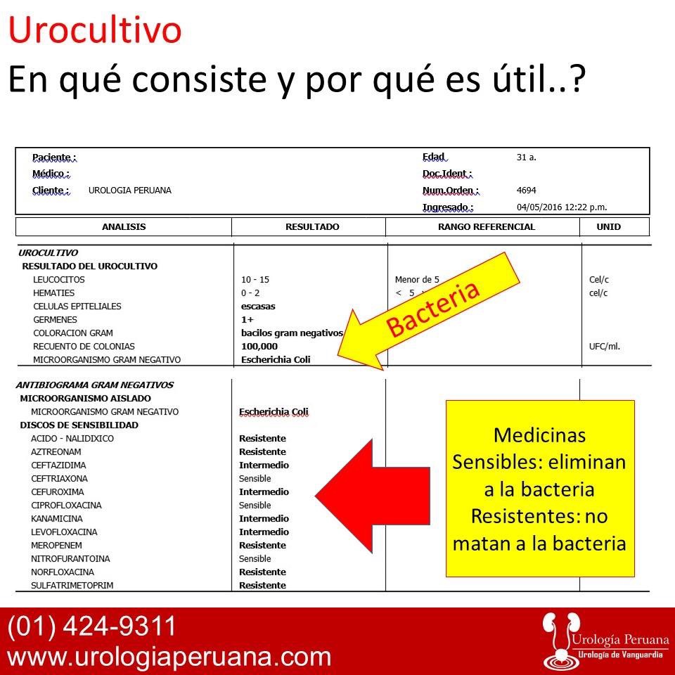 Para que sirve un CULTIVO DE ORINA – Urología Peruana. Dr. Susaníbar