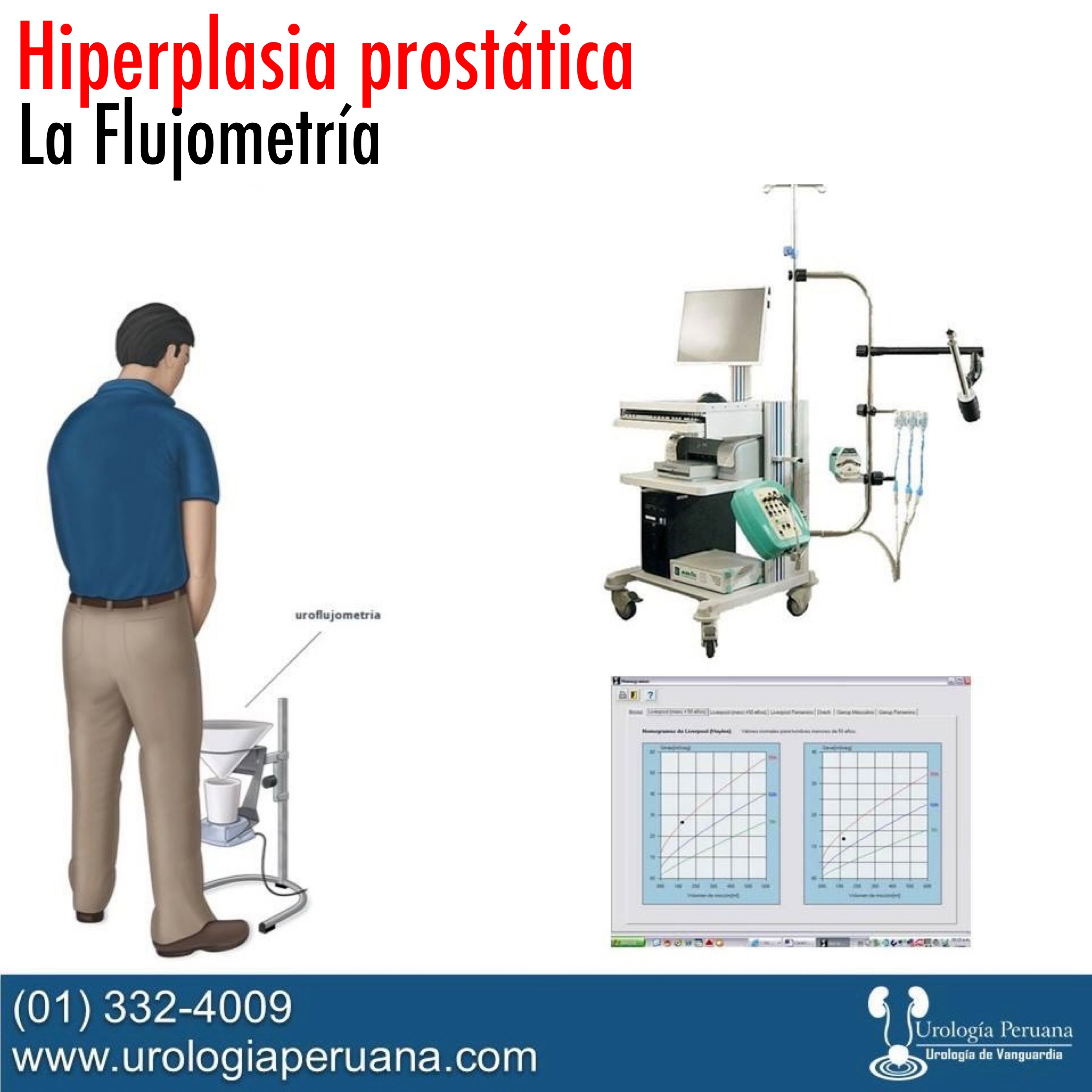 Flujometria – Urología Peruana. Dr. Susaníbar