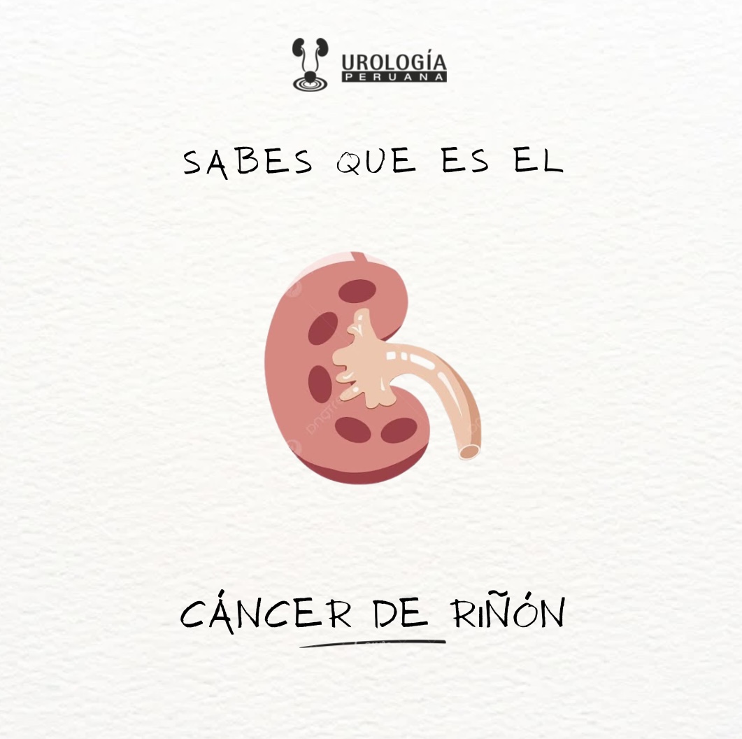 Cáncer de riñón – Urología Peruana. Dr. Susaníbar