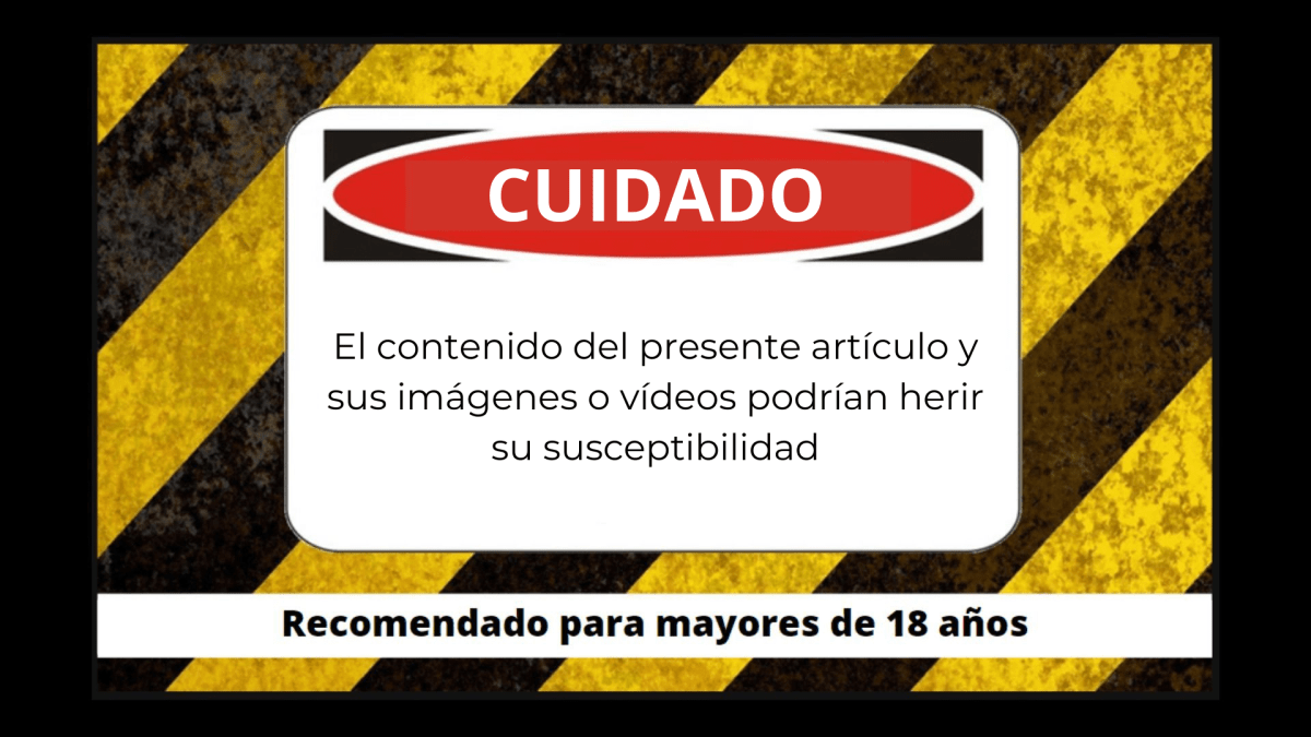Cómo se coloca una prótesis – Urología Peruana. Dr. Susaníbar