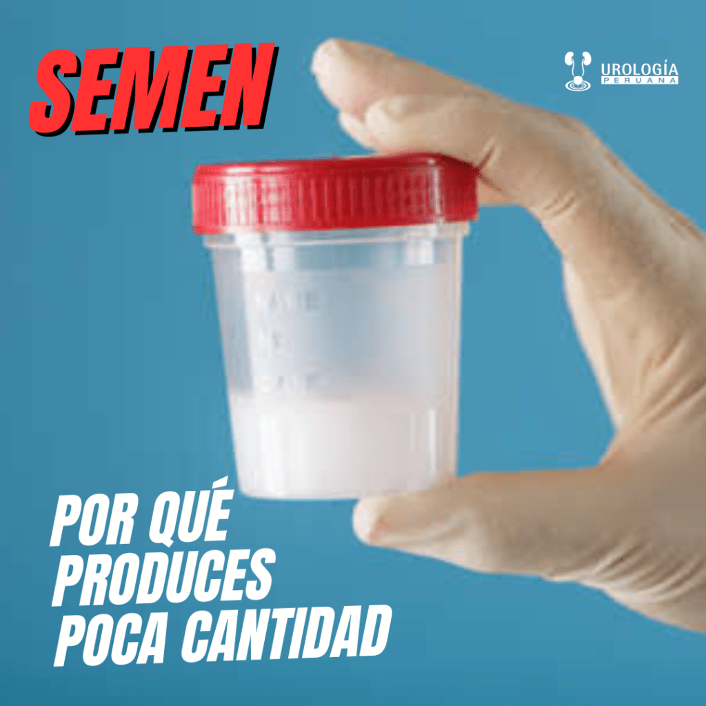 ¿por Qué Produces Poco Semen Urología Peruana Dr Susaníbaremk 7467