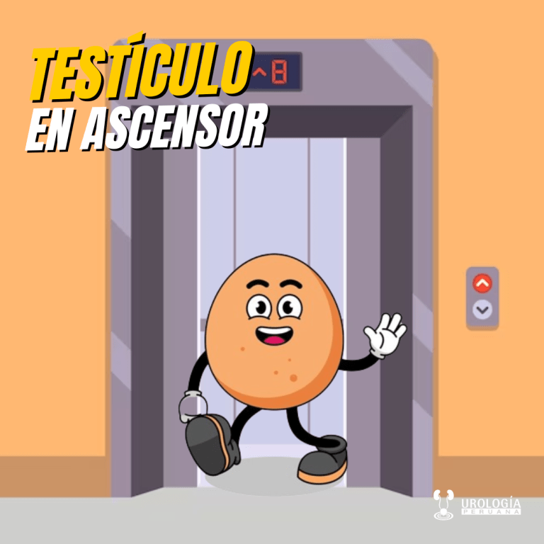 Cuando se te sube un testículo: el testículo en ascensor – Urología ...