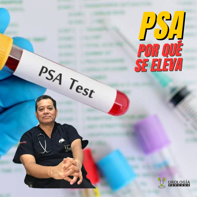 Cáncer de próstata: anatomía – Urología Peruana. Dr. Susaníbar