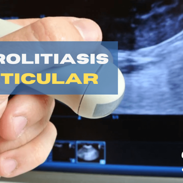 HBP. Tratamiento Médico – Urología Peruana. Dr. Susaníbar