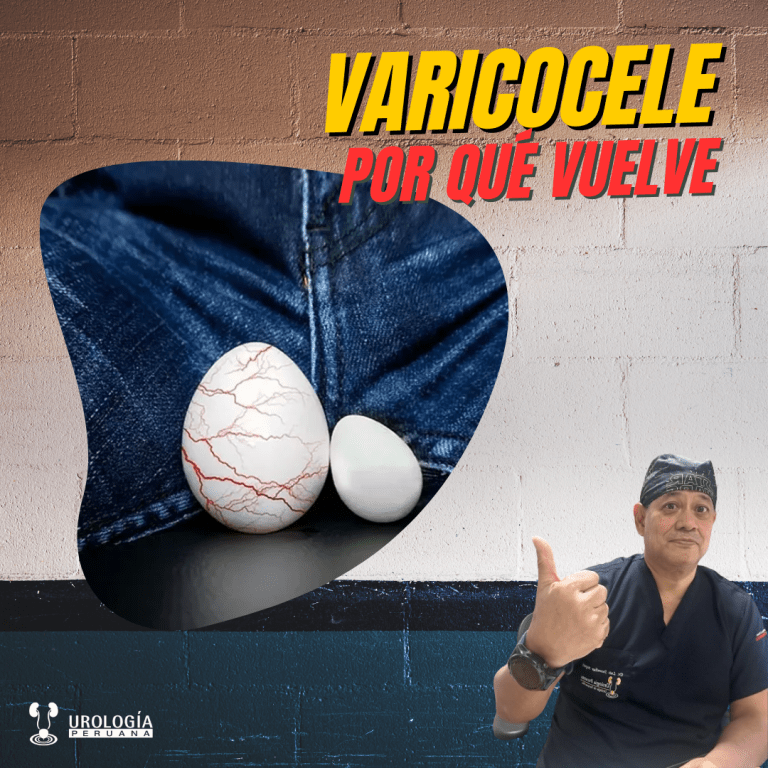 ¿Puede volver el varicocele? – Urología Peruana. Dr. Susaníbar