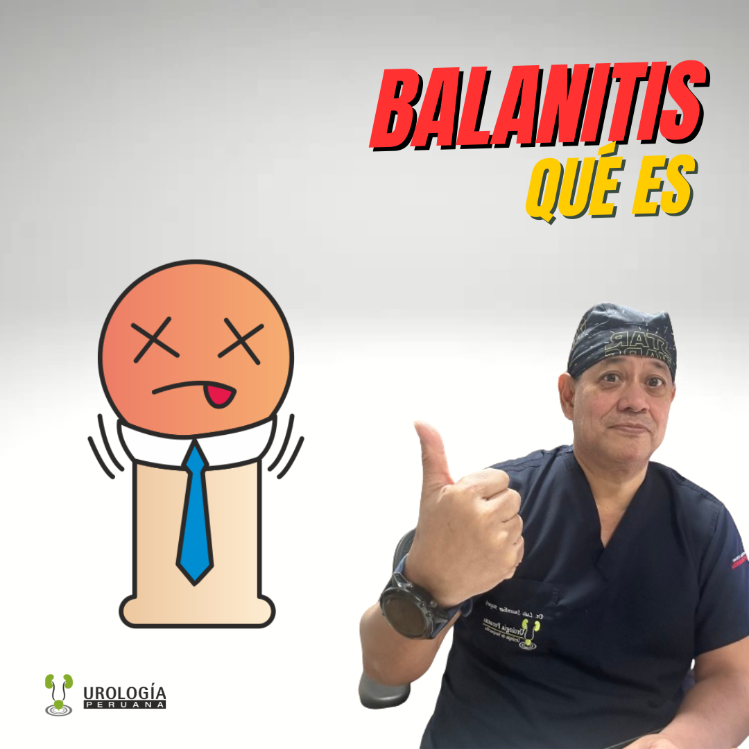 Qué es la balanitis – Urología Peruana. Dr. Susaníbar