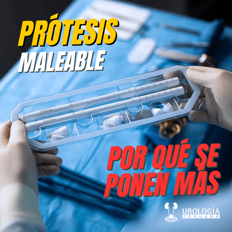 Próstata grado 1 – Urología Peruana. Dr. Susaníbar