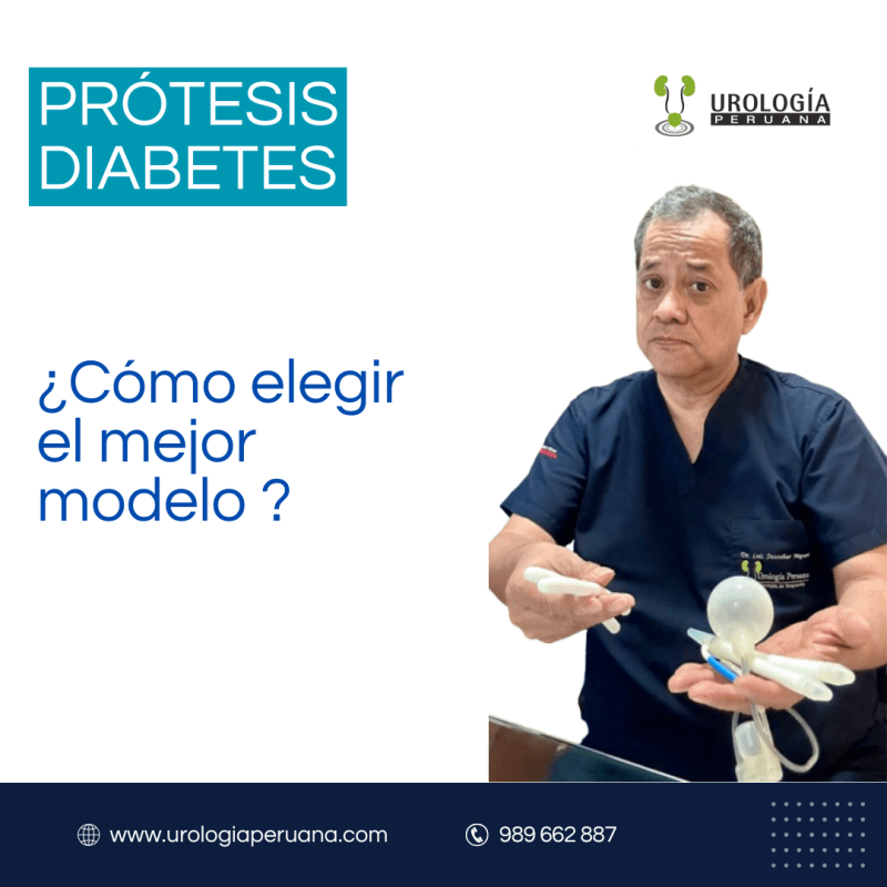 Cómo funciona el finasteride y dutasteride en la próstata – Urología ...