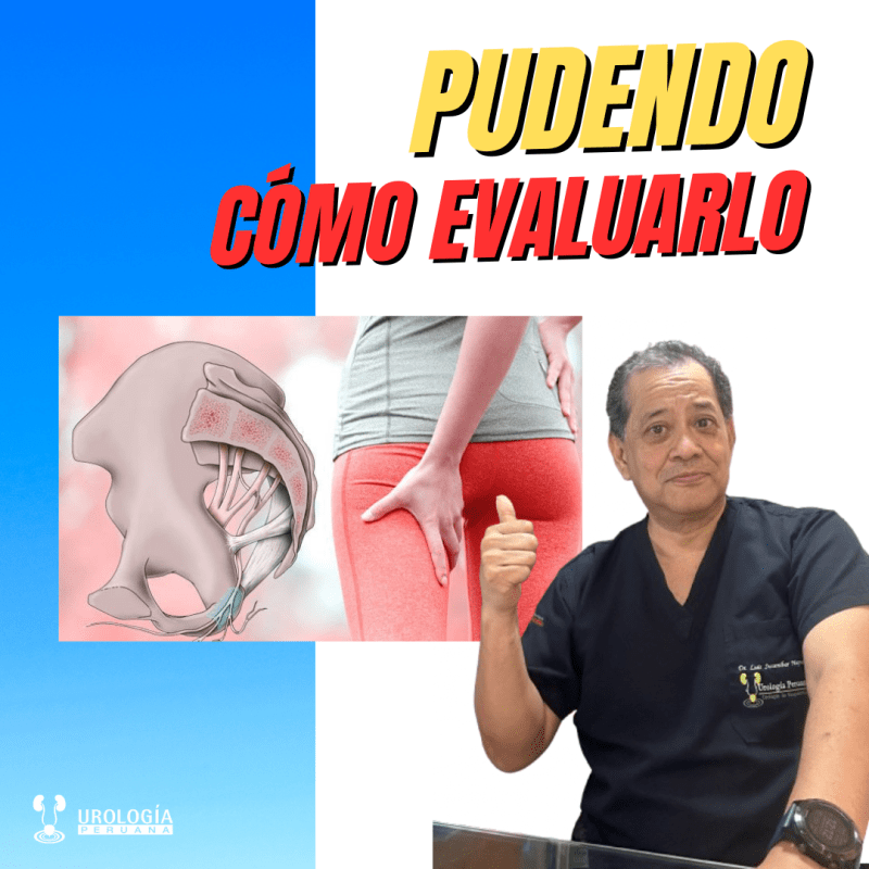 Microlitiasis Testicular: ¿Qué es y qué debo hacer si me la detectan ...