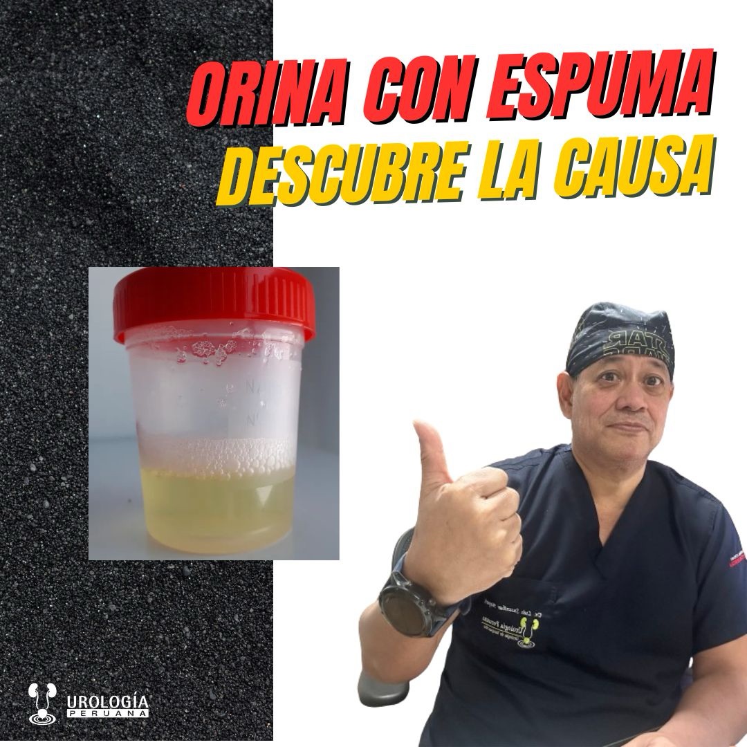 ¿Espuma en la orina? Causas, riesgos y cuándo preocuparse – Urología ...
