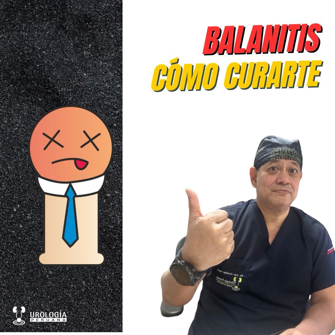 Estrategias para vencer la balanitis: Guía práctica para jóvenes ...