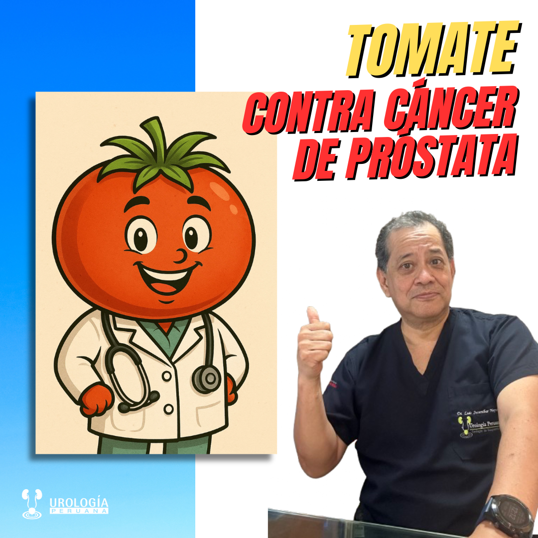 ¿El tomate previene el cáncer de próstata? – Urología Peruana. Dr ...
